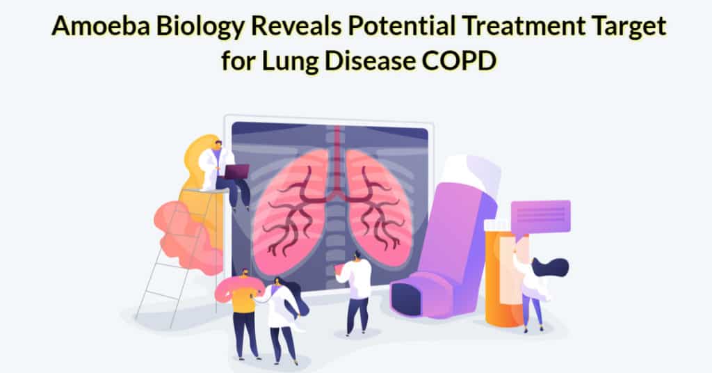 Potential Lung Disease Treatment Revealed by Amoeba Biology